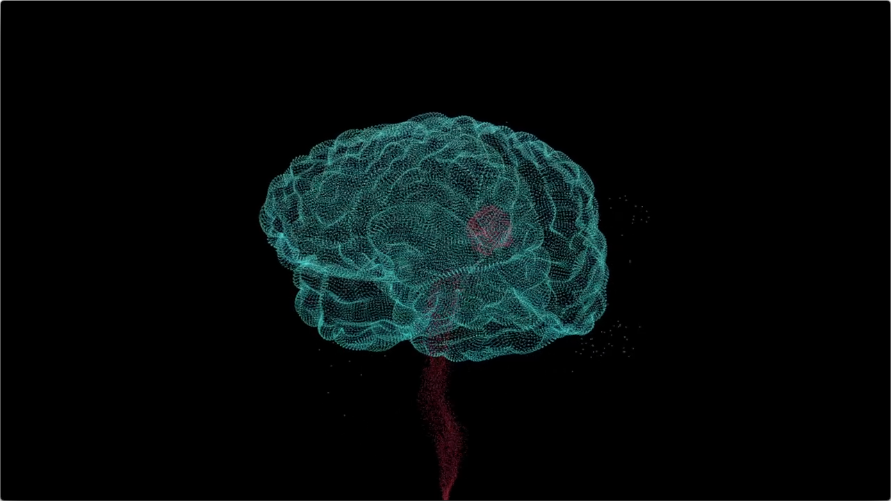 Brain Scan Animation - Jon Baugh Brain Scan Animation - Jon Baugh